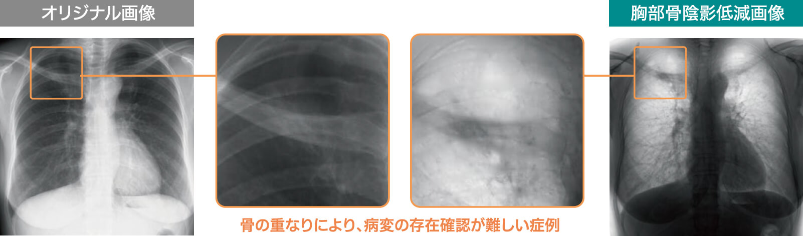 富士画像診断ワークステーション C@RNACORE - 株式会社 栄弘